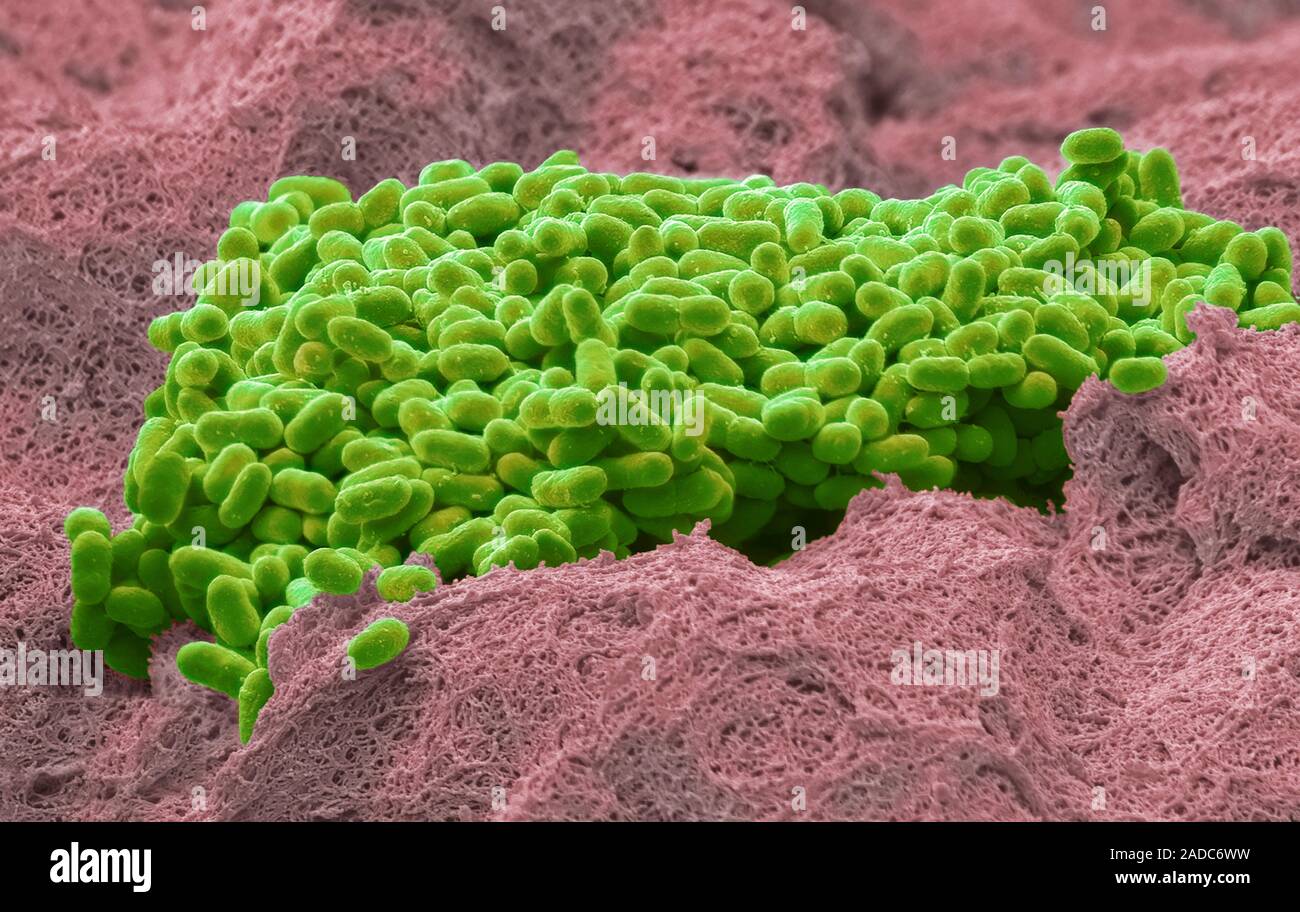 Microbiome. Coloured scanning electron micrograph (SEM) of bacteria ...
