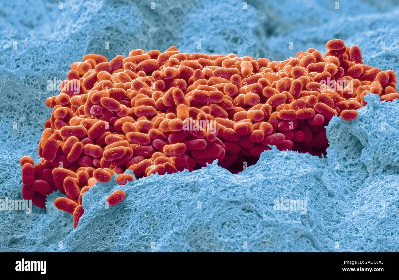 Microbiome. Coloured scanning electron micrograph (SEM) of bacteria ...