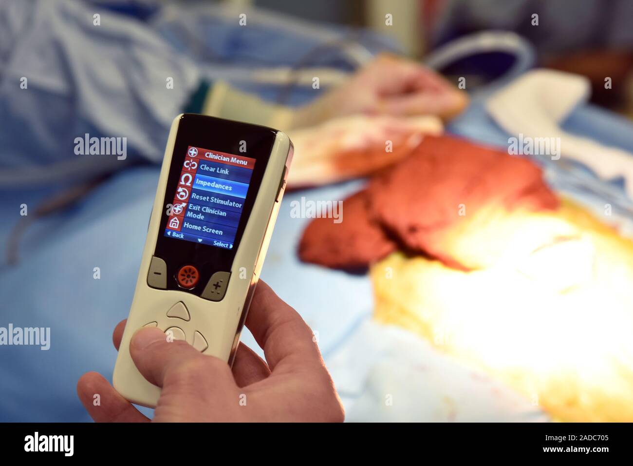 Deep brain stimulation surgery. Control device being used by a surgeon ...