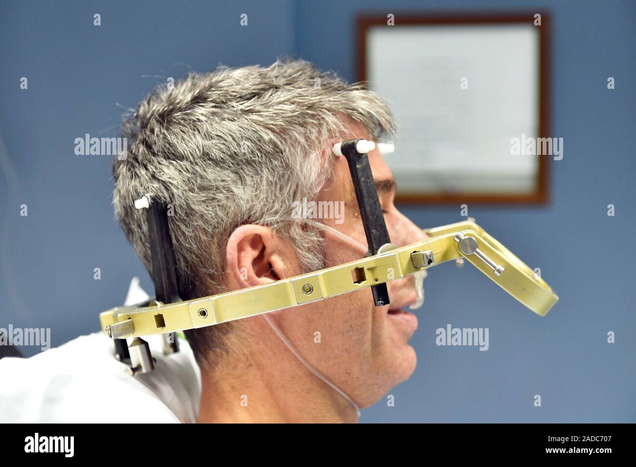 Deep brain stimulation surgery. Stereotactic frame being used on a ...
