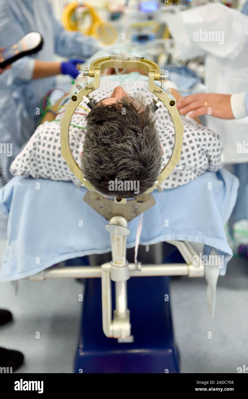 Deep brain stimulation surgery. Stereotactic frame being used on a ...
