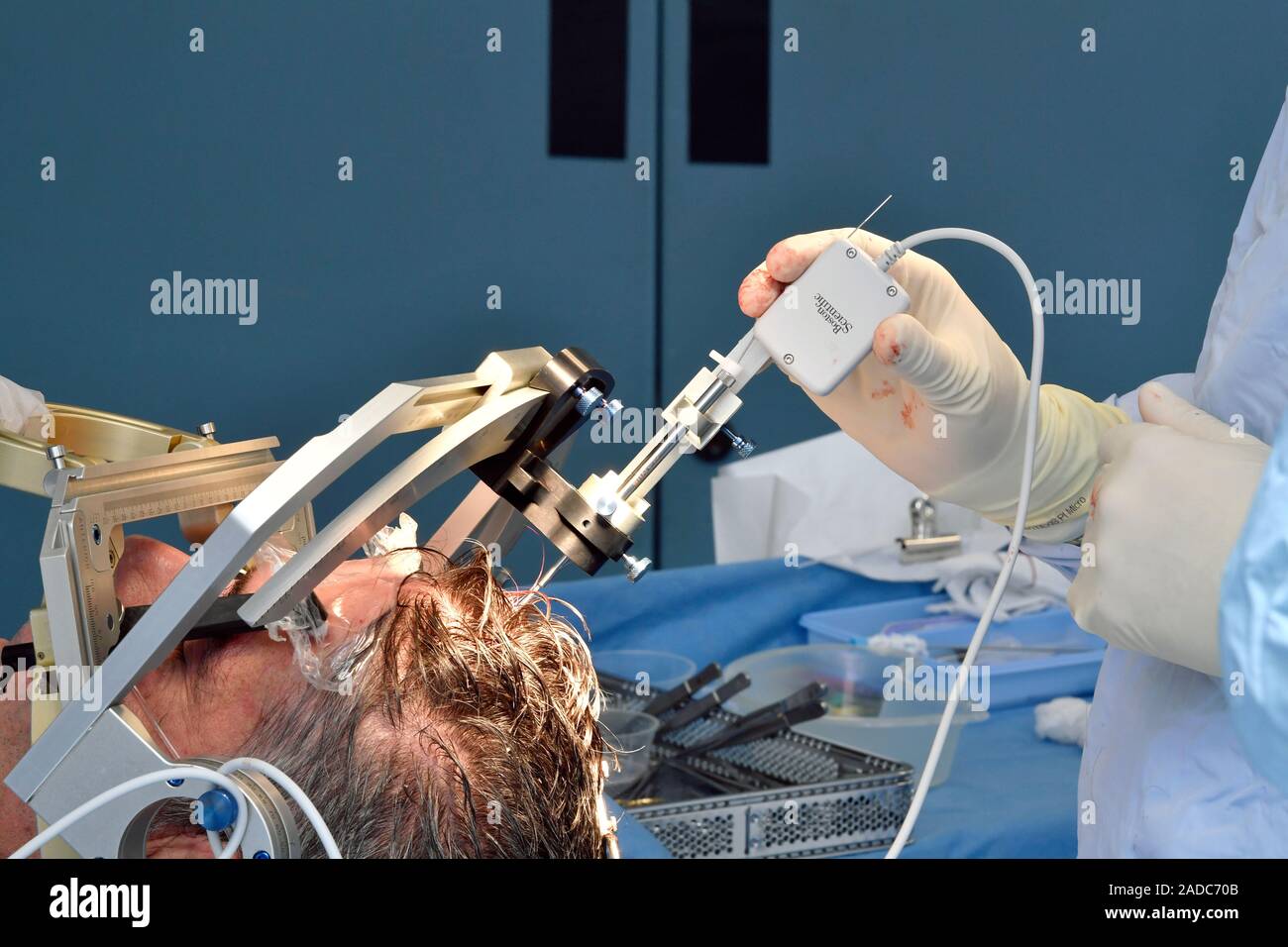 Deep brain stimulation surgery. Surgical tools and stereotactic frame ...