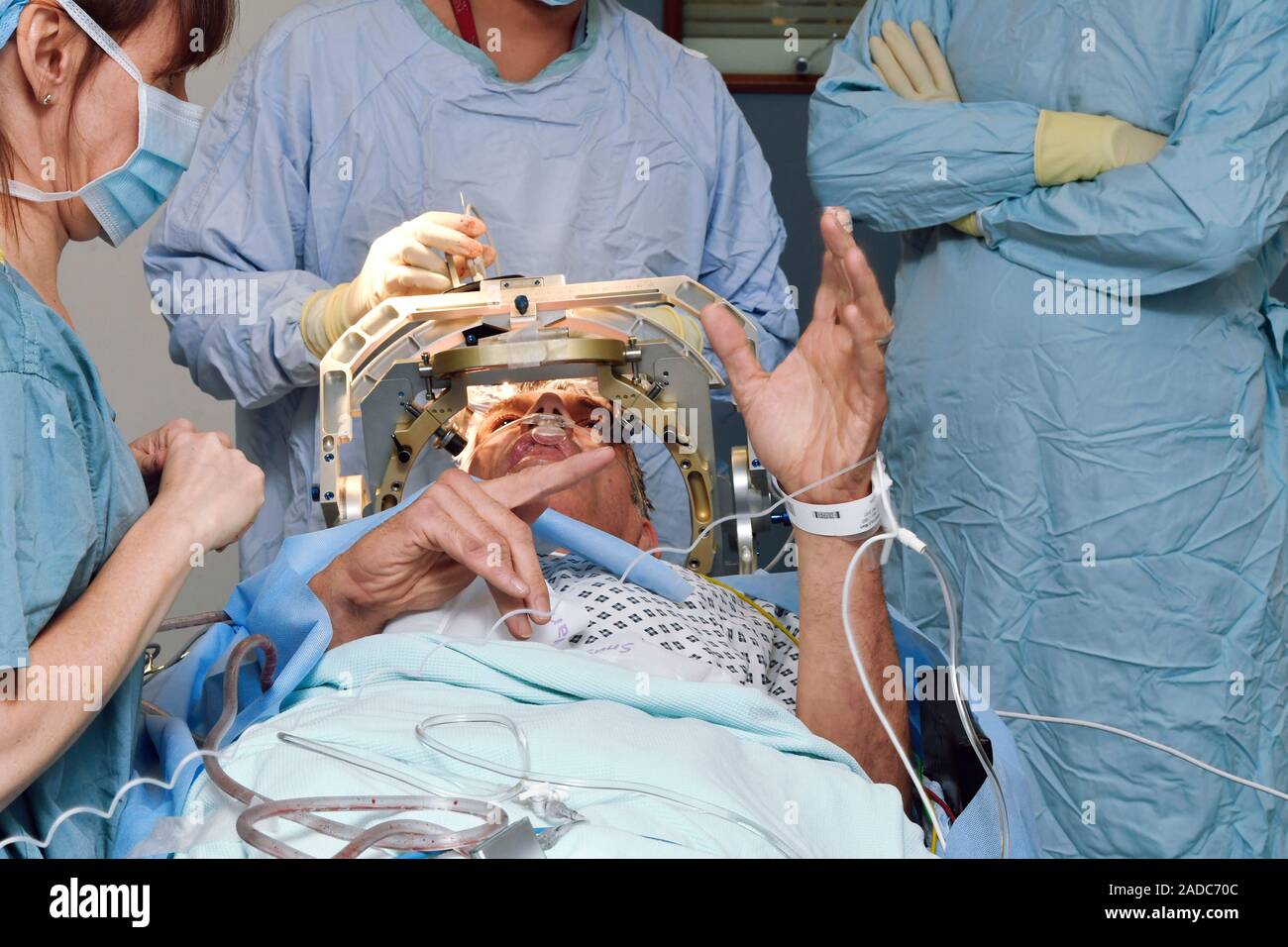 Deep brain stimulation surgery. Neurological test being carried out on ...