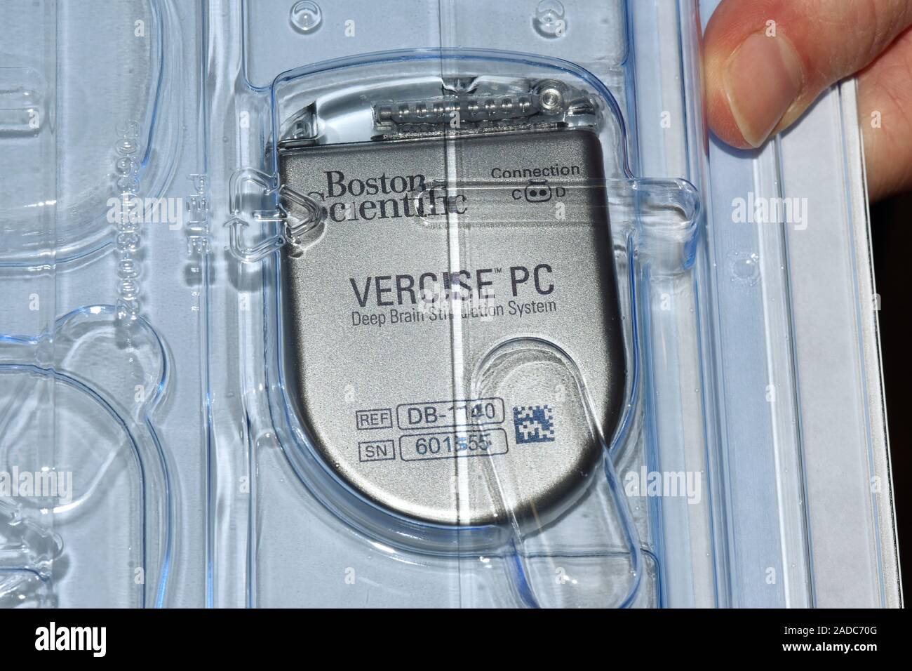 Deep brain stimulation pacemaker. Close-up of the implanted pulse ...