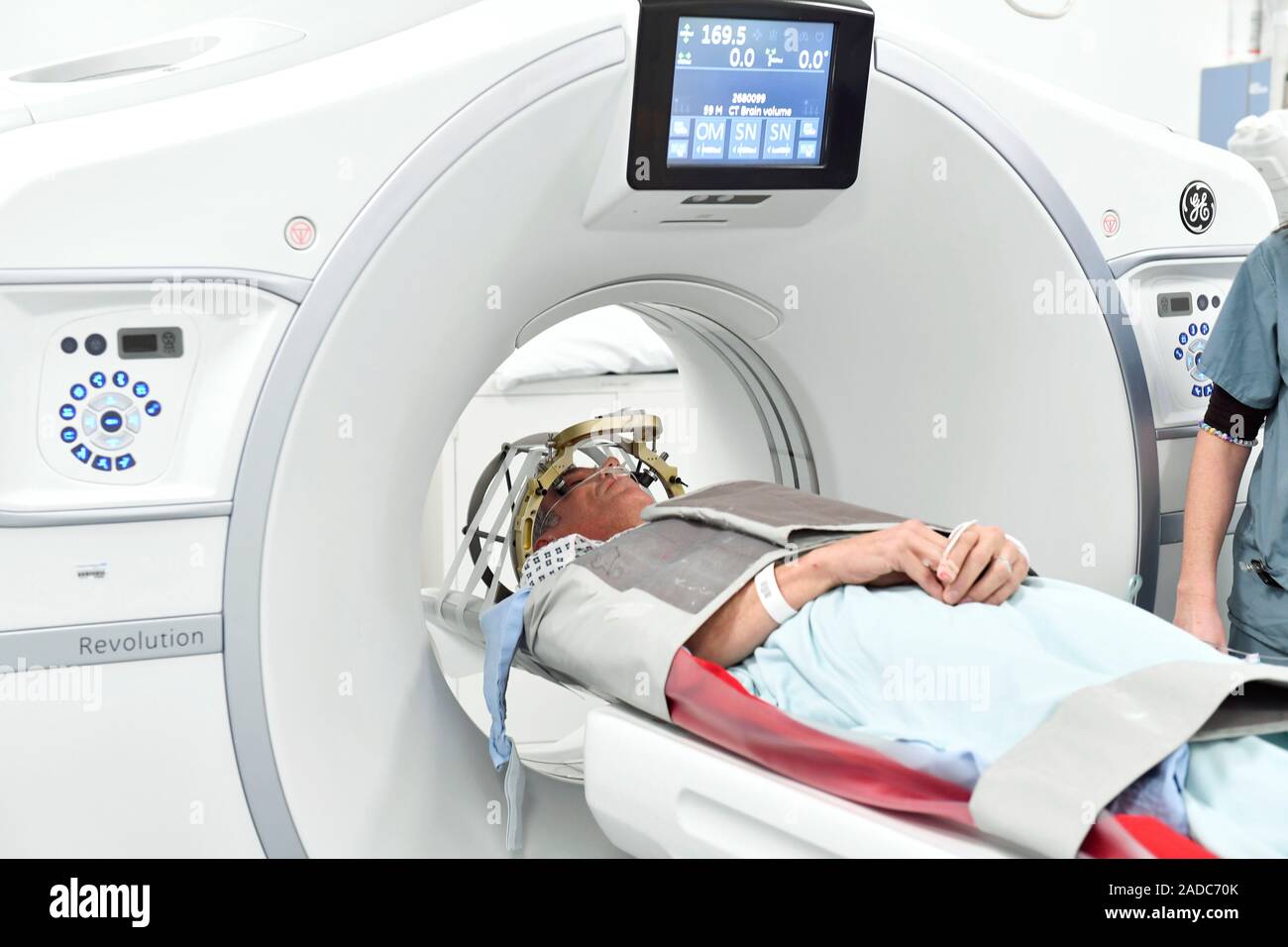 CT scan during deep brain stimulation surgery. 59-year-old man with ...