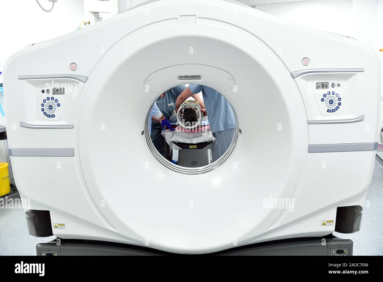 CT scan during deep brain stimulation surgery. 59-year-old man with ...