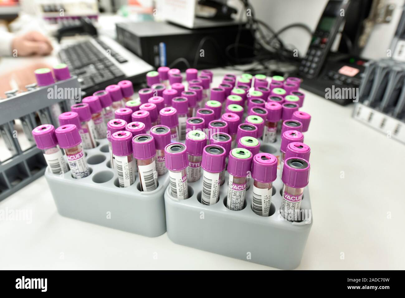 Blood samples. Vacutainer tubes with colour-coded caps containing blood ...