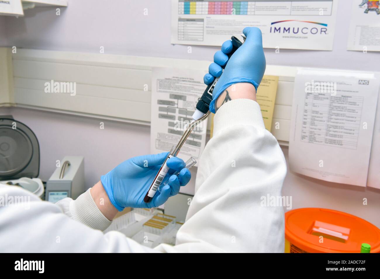 Blood sample analysis. Technician pipetting a sample of blood that is ...