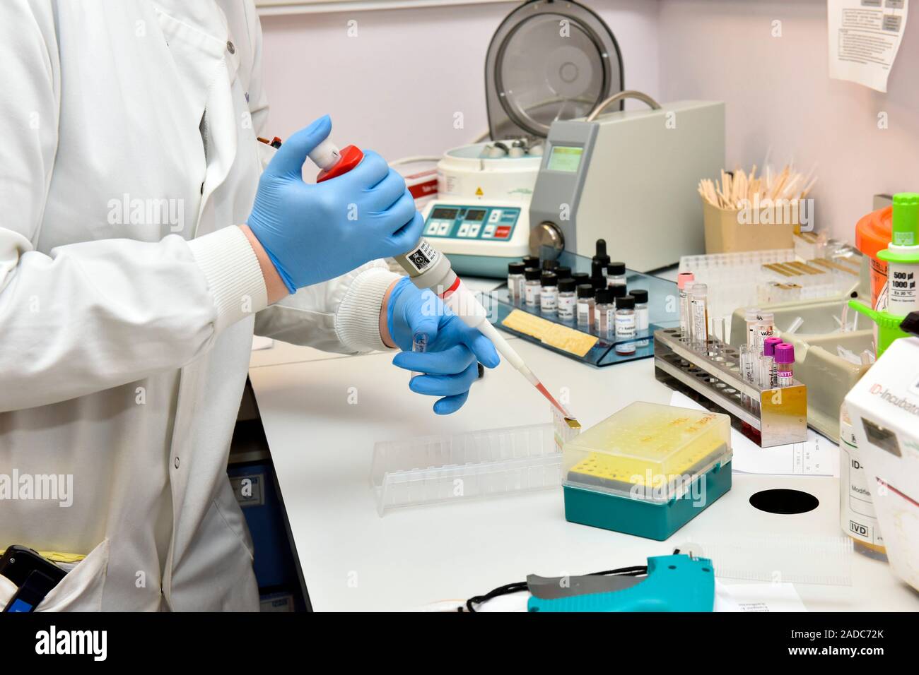 Blood sample analysis. Technician pipetting a sample of blood that is ...