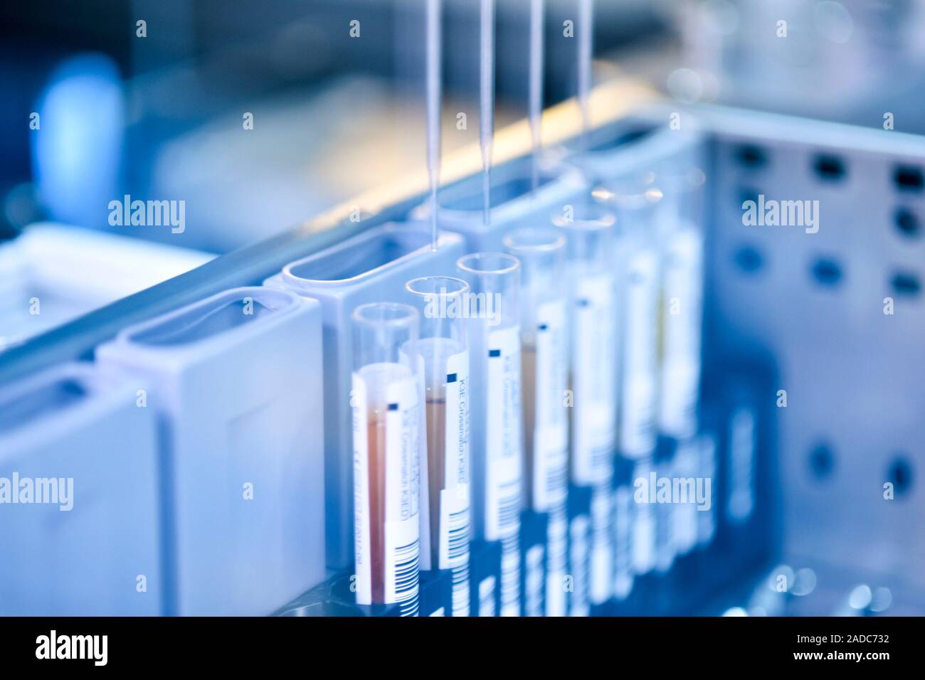 Blood sample analysis. Pipetting machine being used to handle samples ...