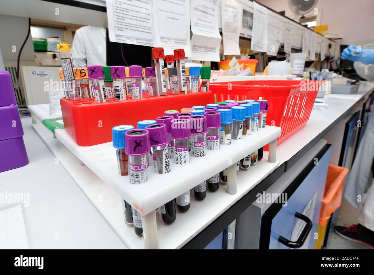 Samples in a pathology laboratory. Colour-coded samples that are being ...