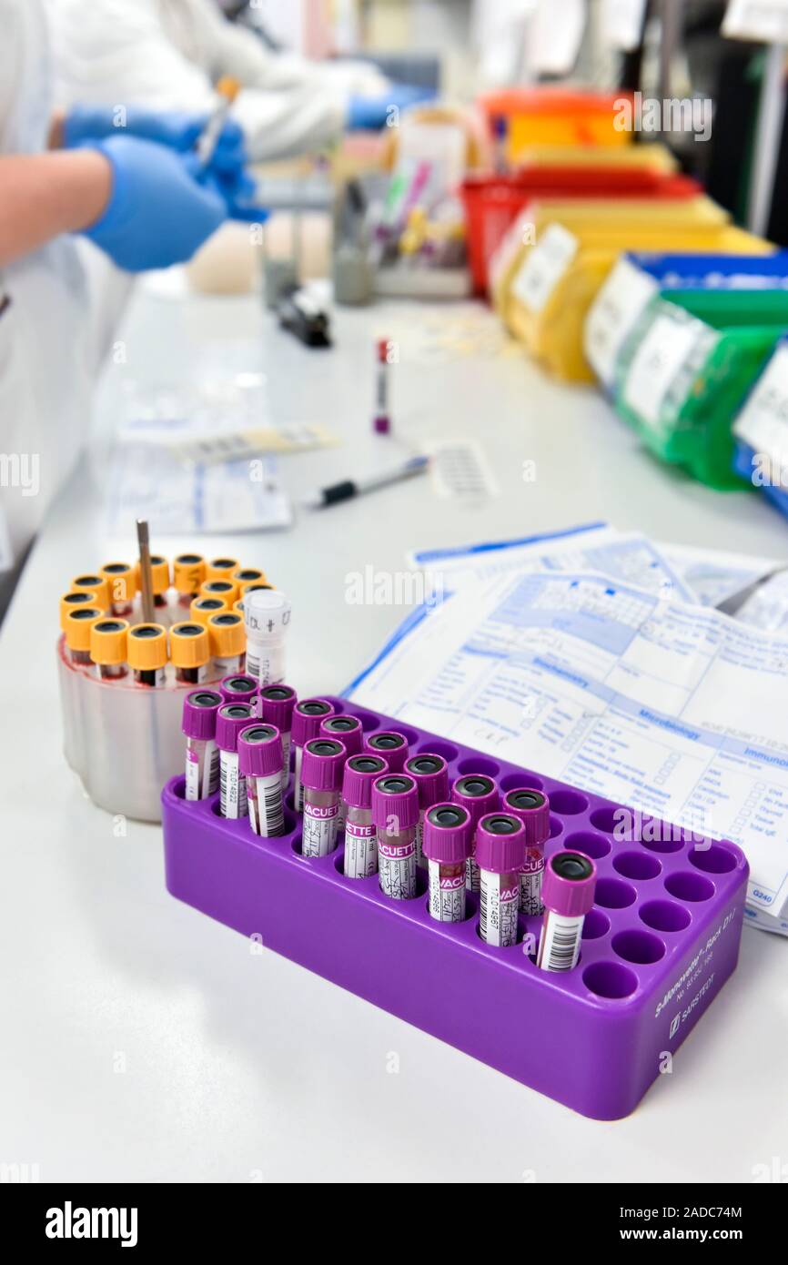 Samples in a pathology laboratory. Colour-coded samples that are being ...
