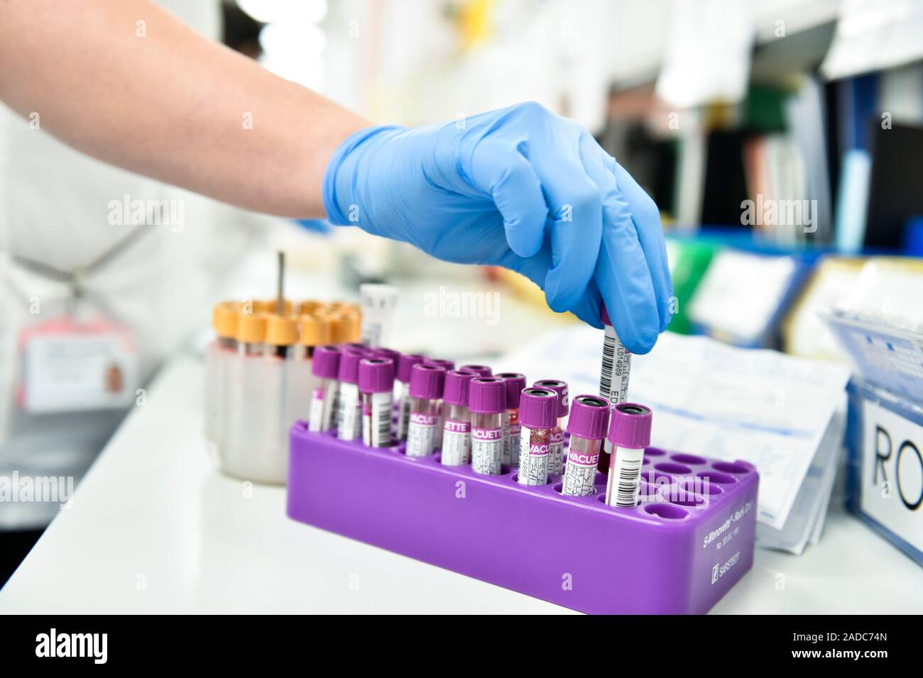 Pathology sample analysis. Technician handling samples that are being ... Pathology sample analysis. Technician handling samples that are being ...