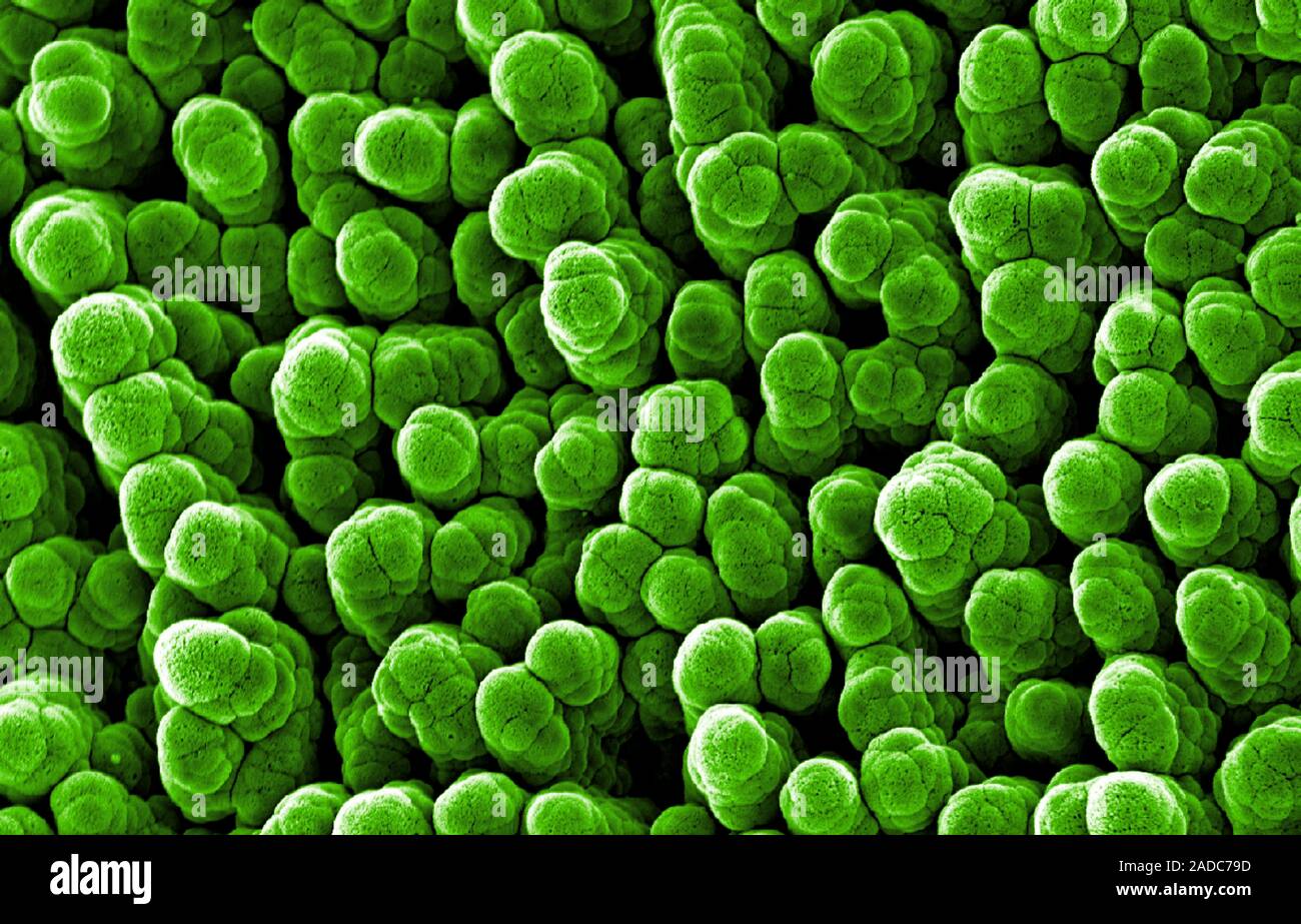 Microstructures on titanium. Coloured scanning electron micrograph (SEM ...