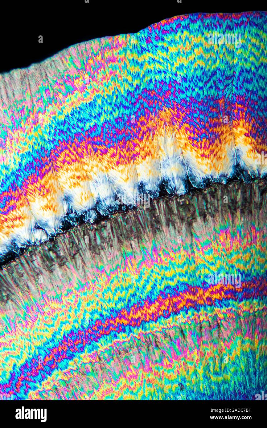 Vitamin C crystals, polarised light micrograph. Vitamin C, ascorbic ...