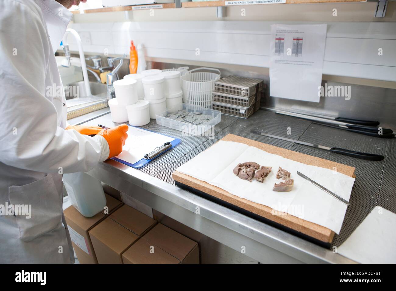 Heart attack specimen preparation. Forensic laboratory technician ...