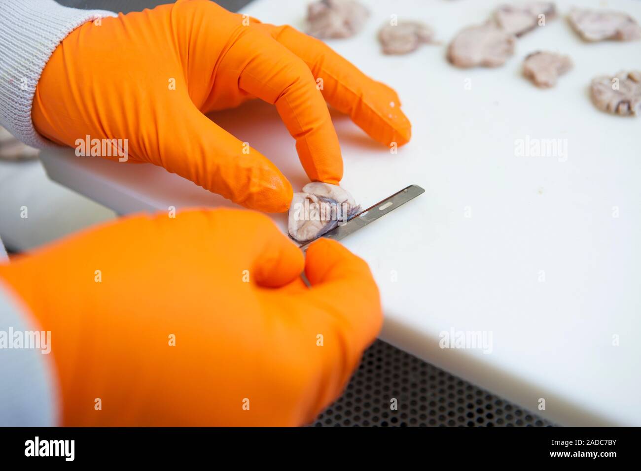 Brain specimen preparation. Close-up of the hands of a forensic ...