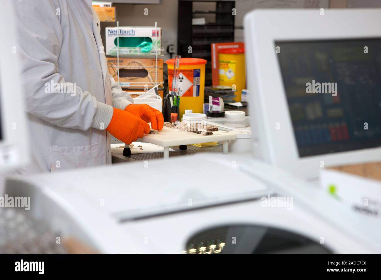 Brain specimen preparation. Forensic laboratory technician preparing ...