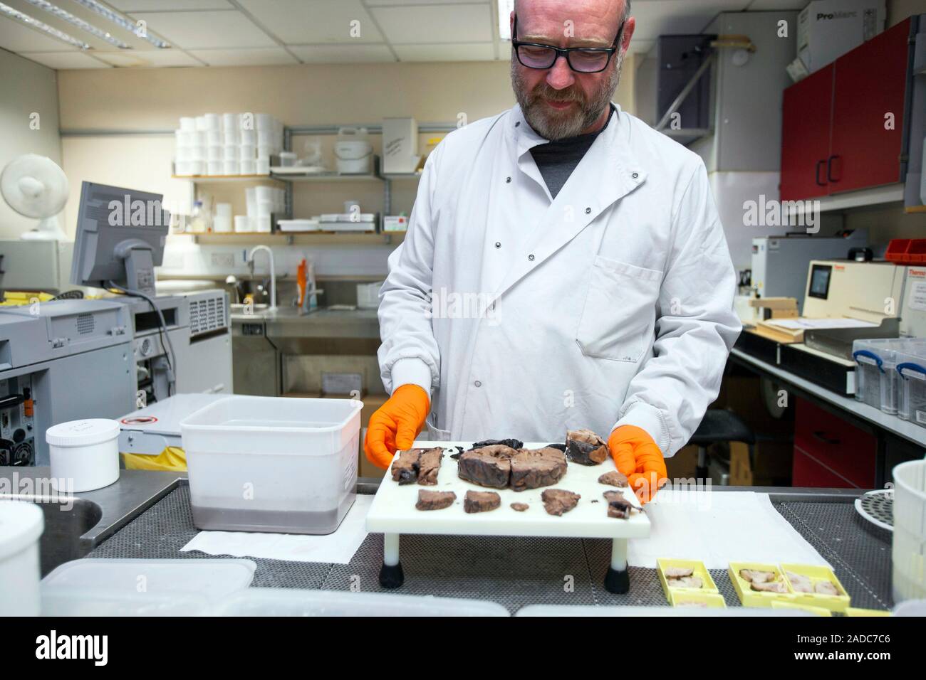 Brain trauma specimen preparation. Forensic laboratory technician with ...