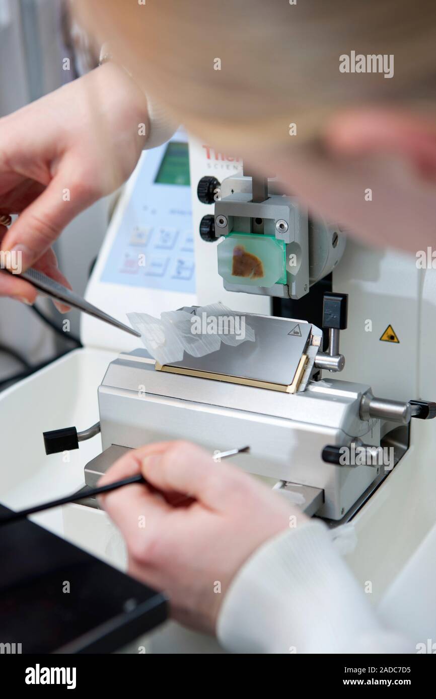 Brain specimen slice preparation. Close-up of a forensic laboratory ...