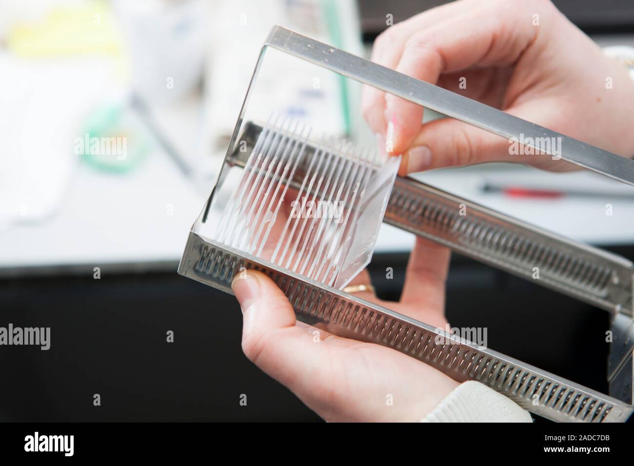 Brain specimens on glass slides. Close-up of a forensic laboratory ...