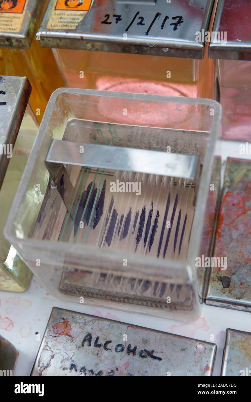 Dyed tissue specimens. Dyed tissue specimen slices that have been ...