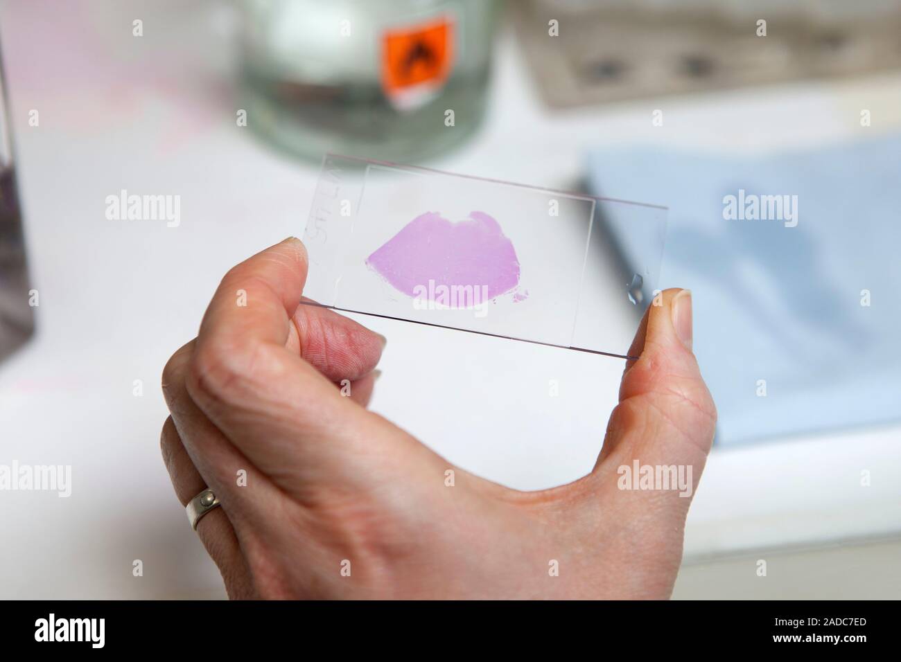 Dyed tissue specimen. Close-up of a forensic laboratory technician ...