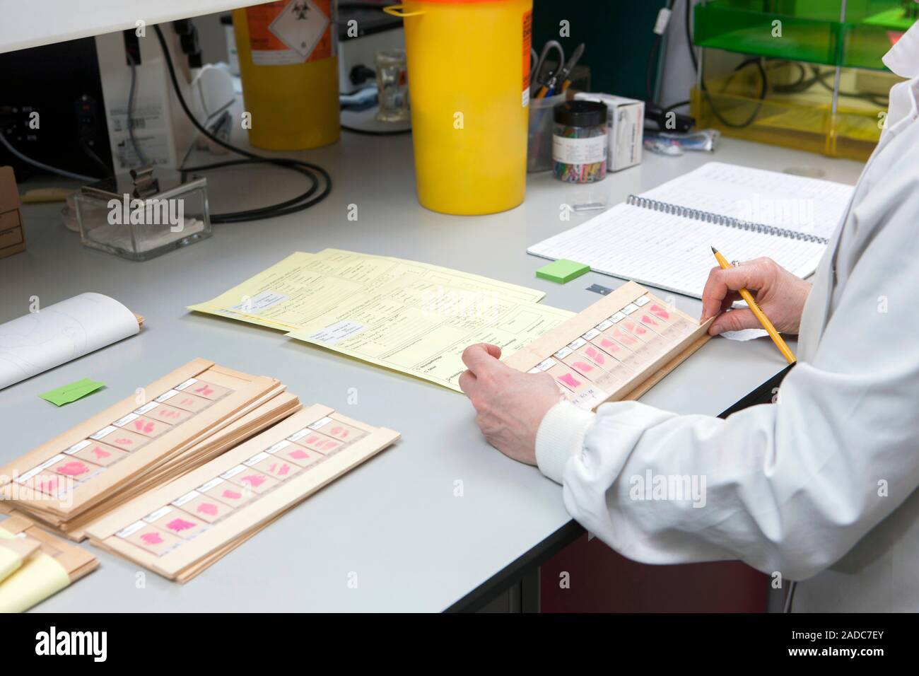 Dyed brain and tissue specimens. Forensic laboratory technician ...