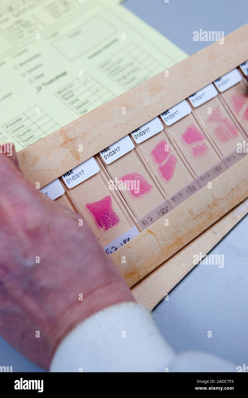 Dyed brain and tissue specimens. Close-up of a forensic laboratory ...