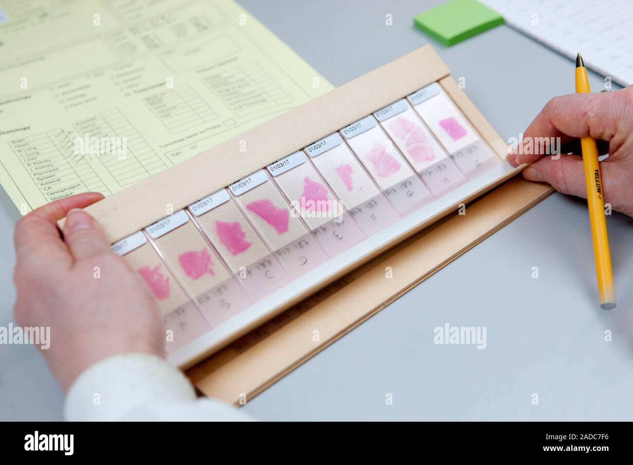 Dyed brain and tissue specimens. Close-up of a forensic laboratory ...