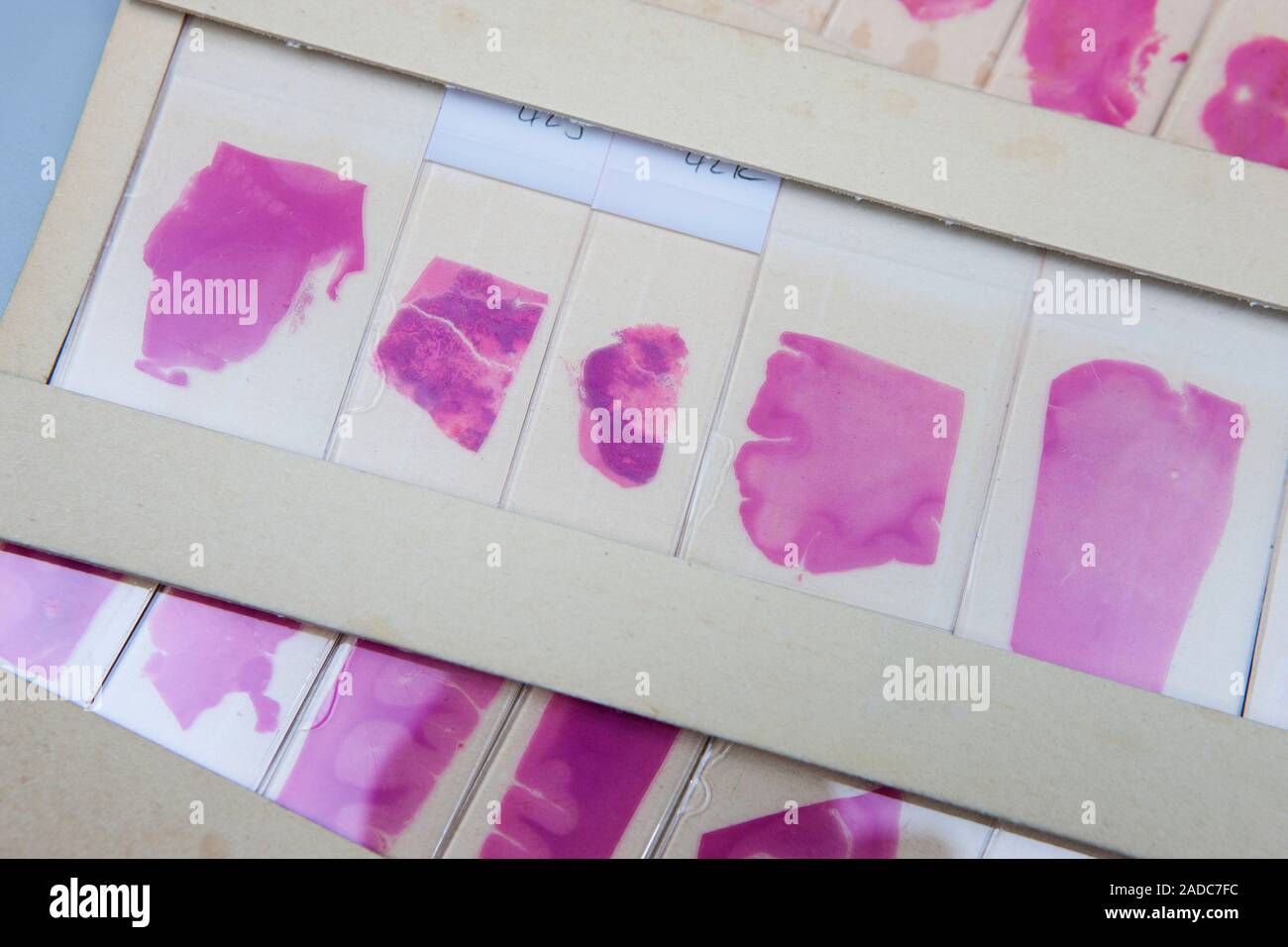 Dyed brain and tissue specimens. Close-up of dyed brain and other ...