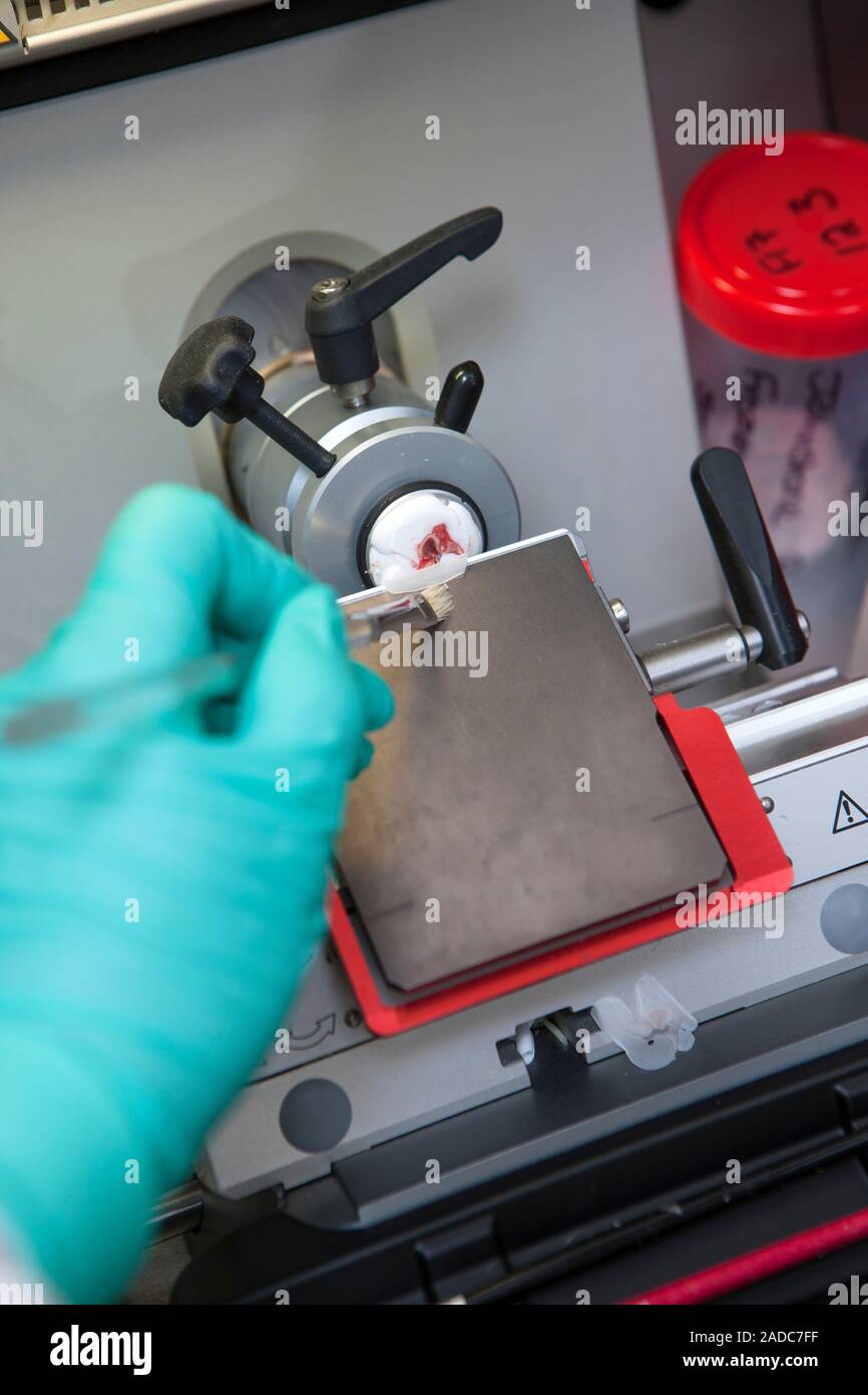 Heart specimen slice preparation. Close-up of a forensic laboratory ...