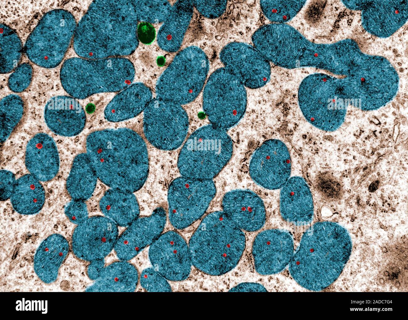 False colour transmission electron micrograph (TEM) showing ...