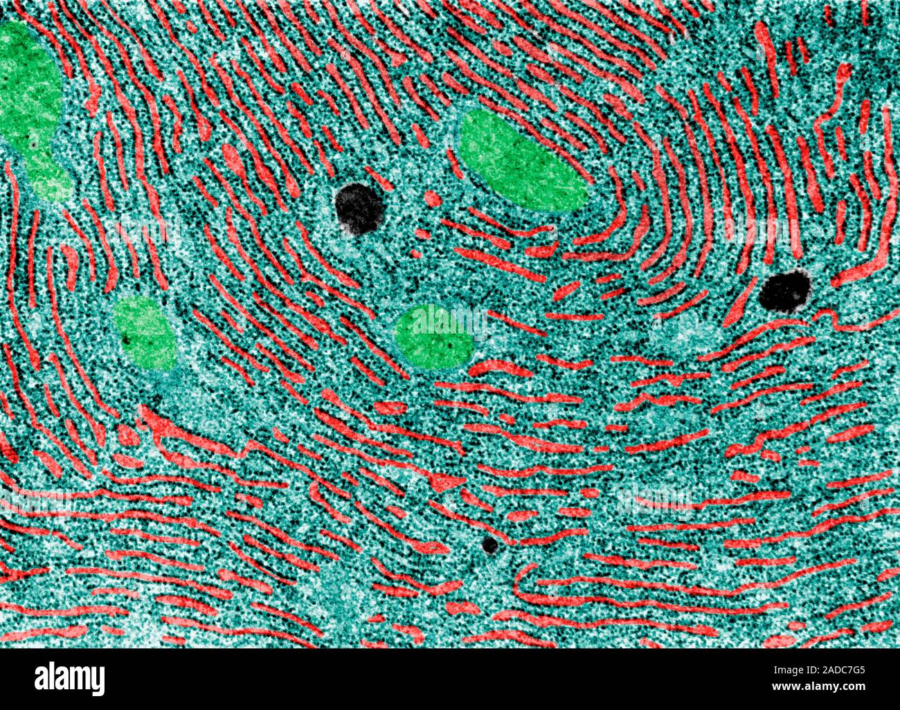 False colour transmission electron micrograph (TEM) showing the ...