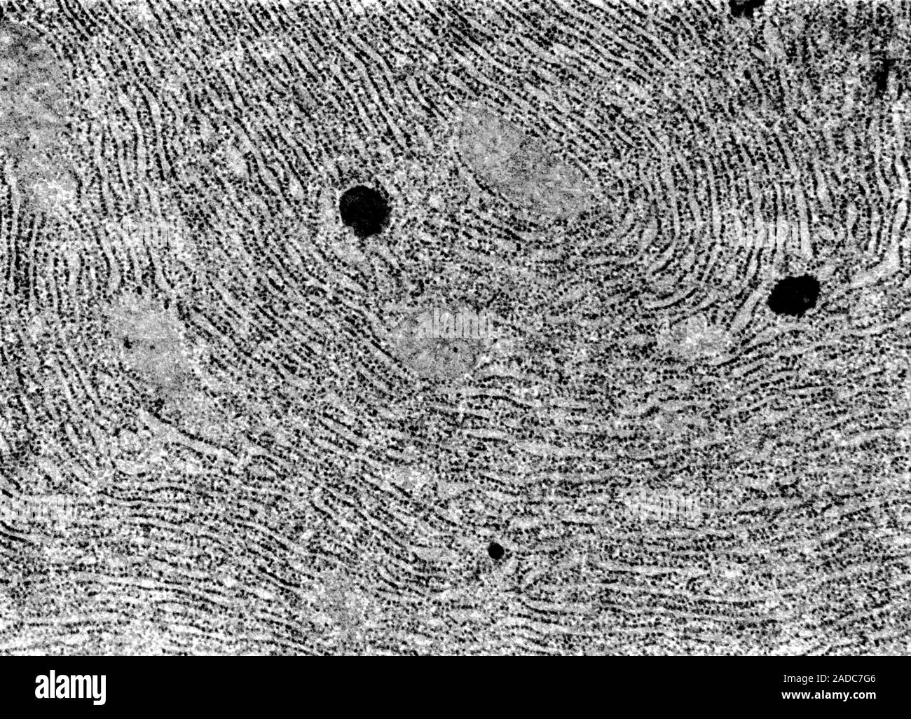 Transmission electron micrograph (TEM) showing the cytoplasm of a ...