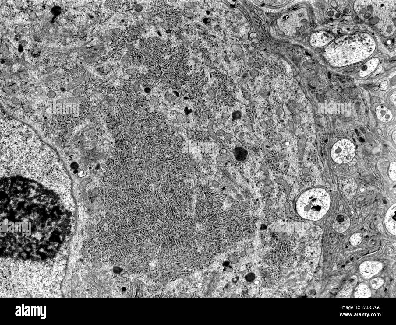 Transmission Electron Micrograph Tem Showing The Cell Body Of A