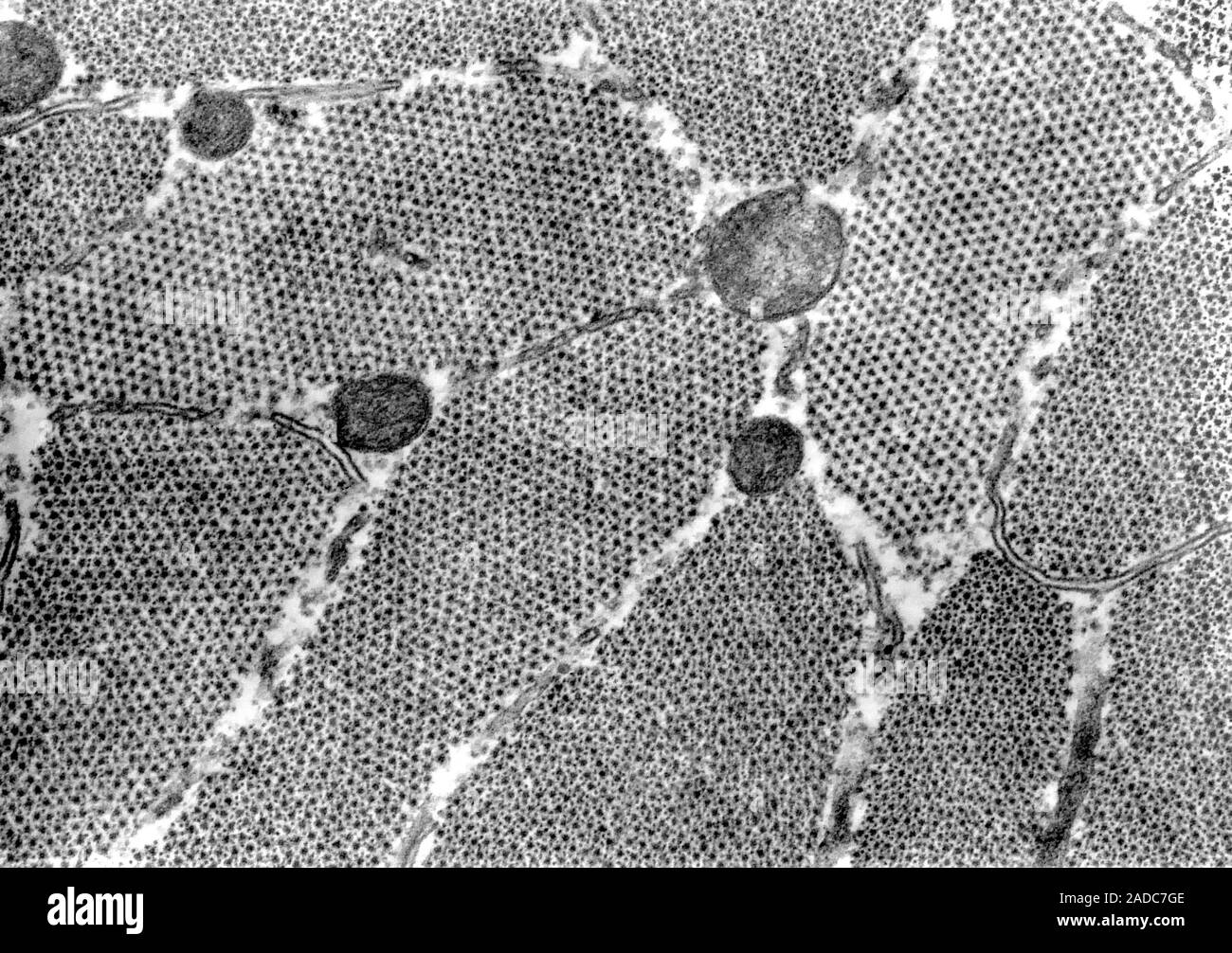 Transmission electron micrograph (TEM) showing cross-sectioned muscle myofibrils at the A-band ...