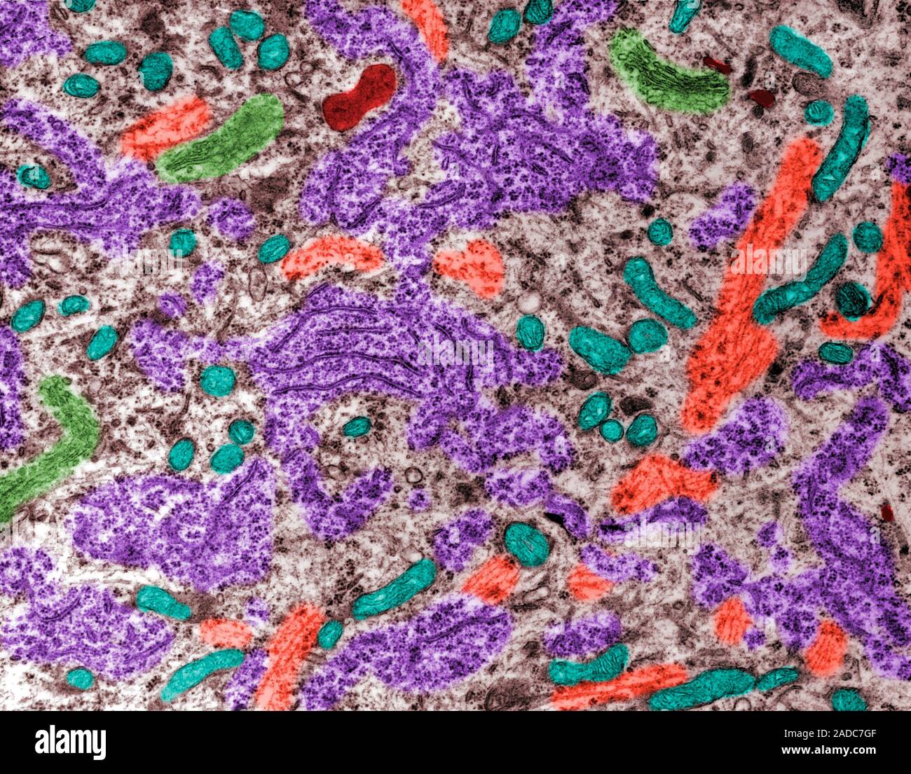 False colour transmission electron micrograph (TEM) showing a nerve ...