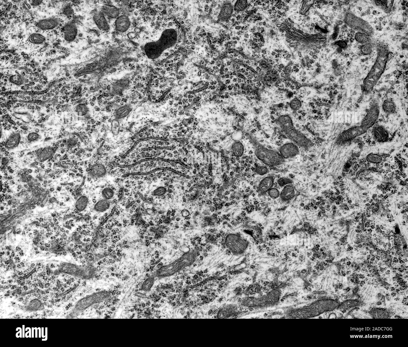 Transmission electron micrograph (TEM) showing a nerve cell body. The ...