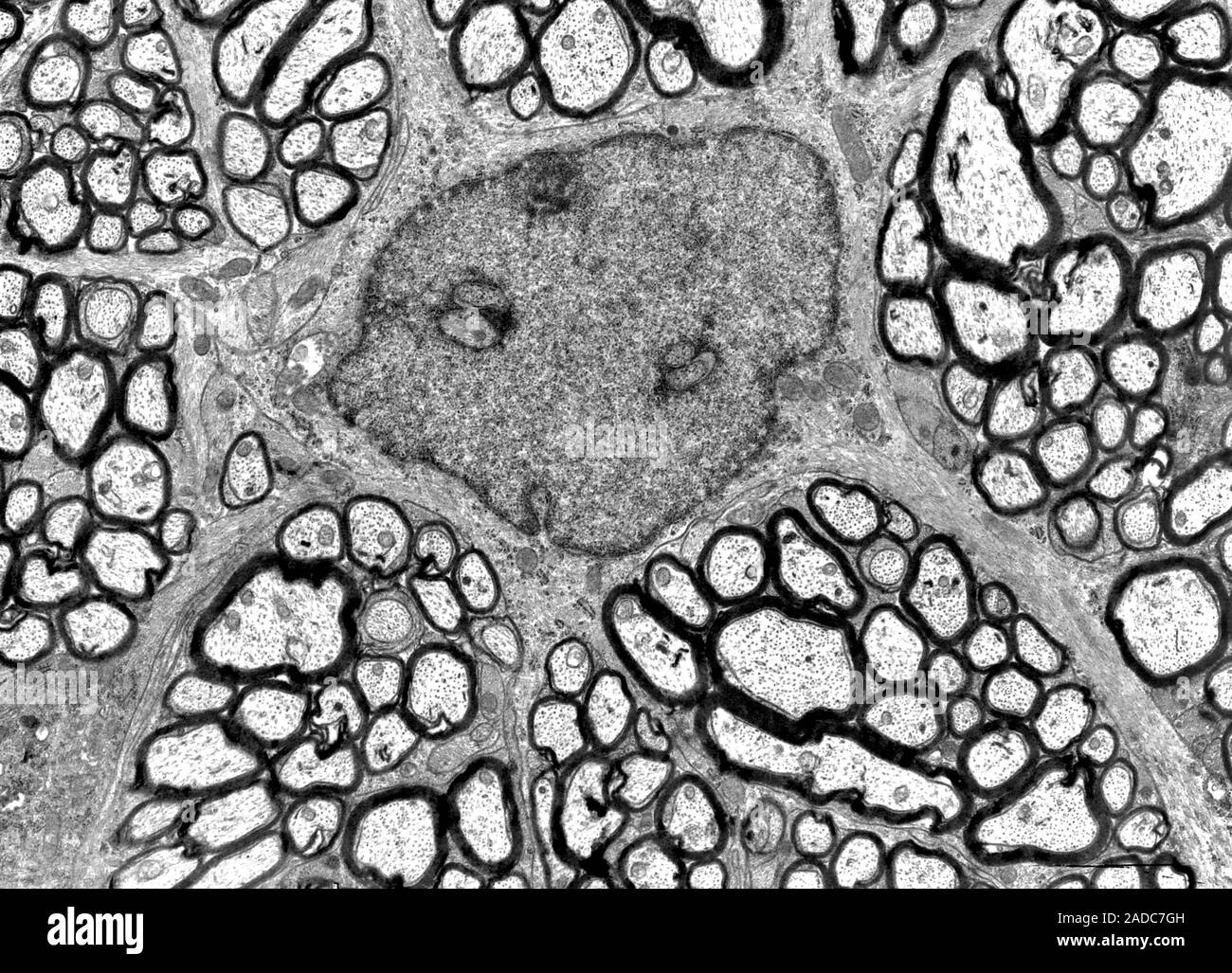 Transmission electron micrograph (TEM) showing a fibrous astrocyte ...
