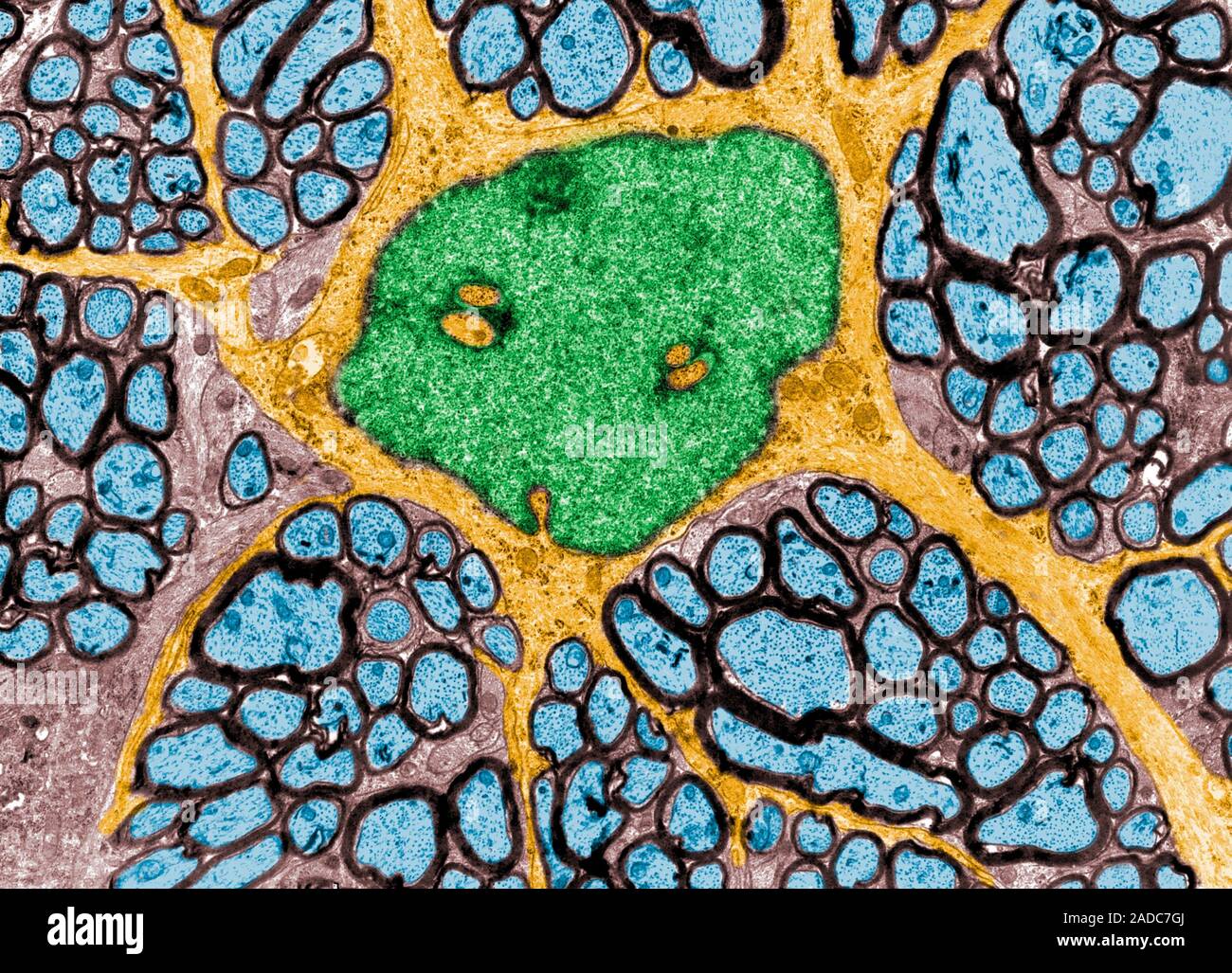 False colour transmission electron micrograph (TEM) showing a fibrous ...