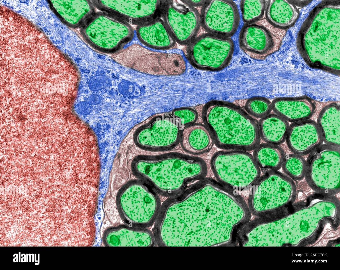 False colour electron micrograph (TEM) showing a fibrous astrocyte ...