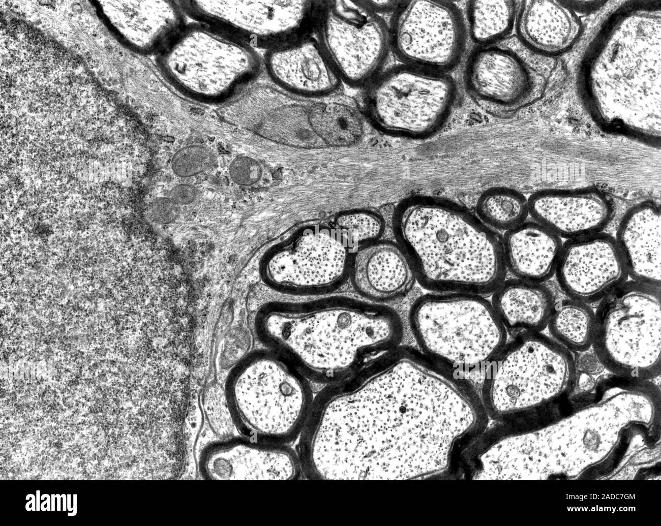 Transmission electron micrograph (TEM) showing a fibrous astrocyte ...
