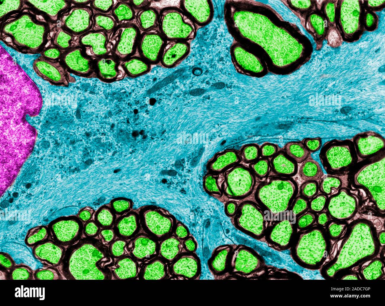 False colour electron micrograph (TEM) showing a fibrous astrocyte ...