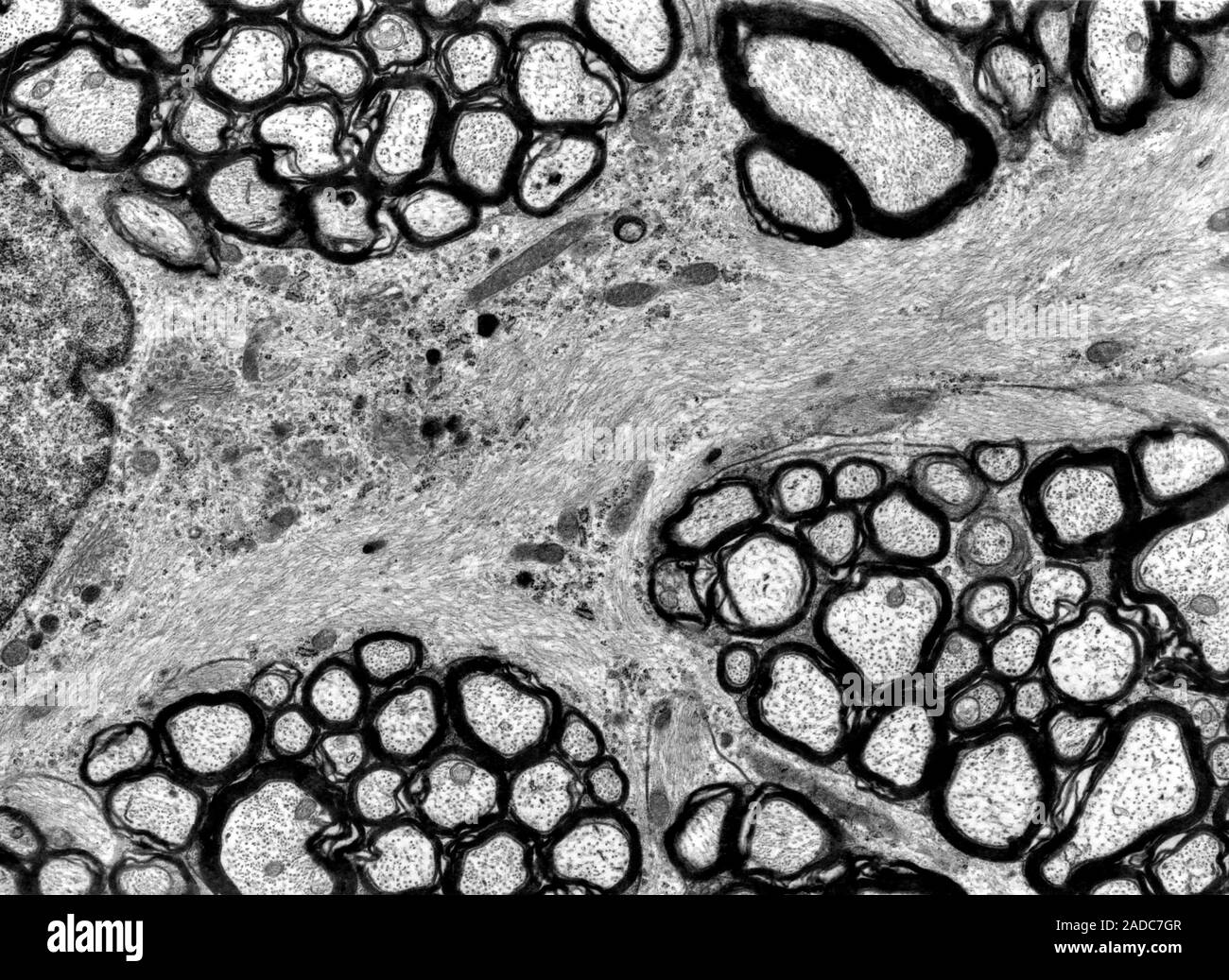 Transmission electron micrograph (TEM) showing a fibrous astrocyte ...