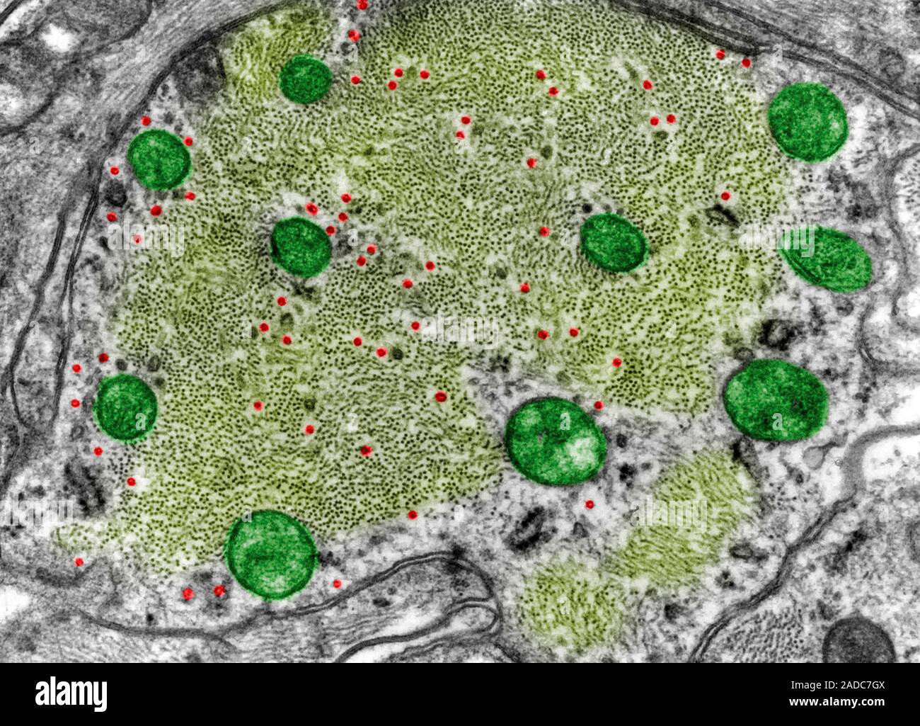 False colour transmission electron micrograph (TEM) showing many ...