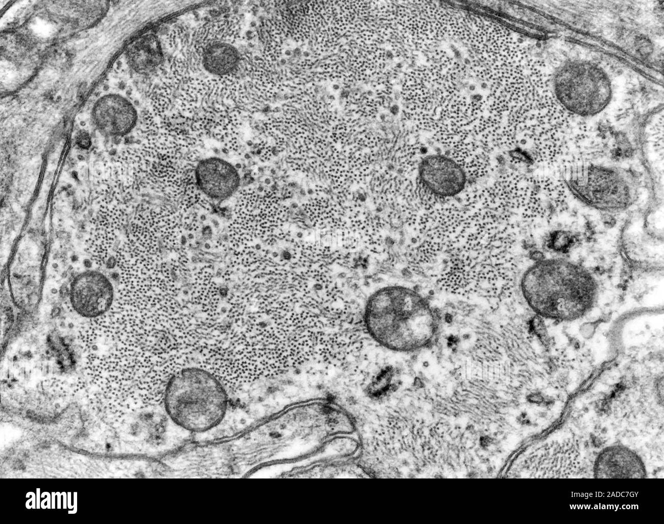 Transmission electron micrograph (TEM) showing an astrocyte process ...