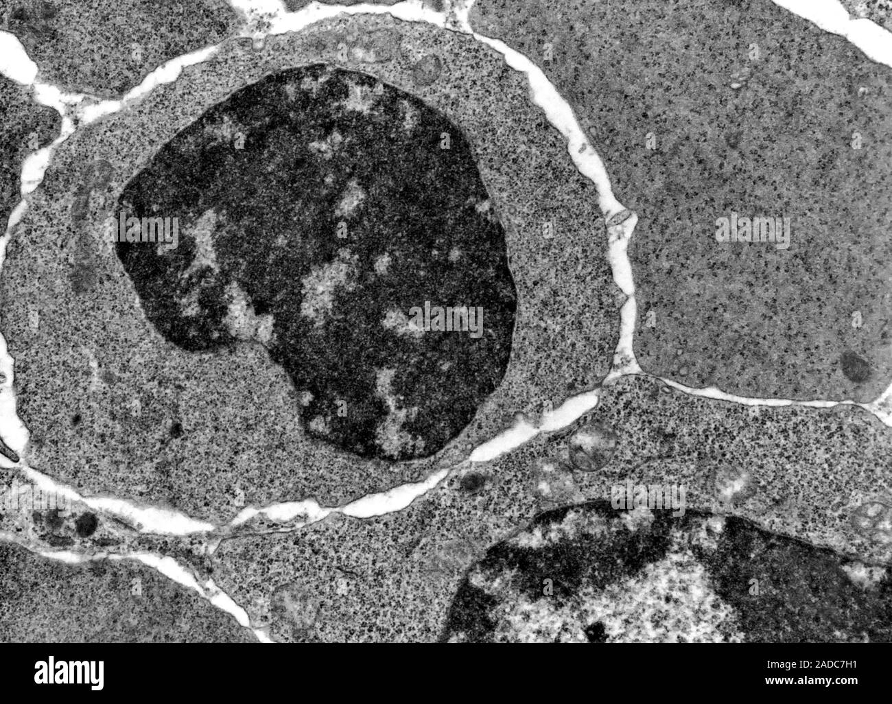 Transmission electron micrograph (TEM) showing three stages of ...