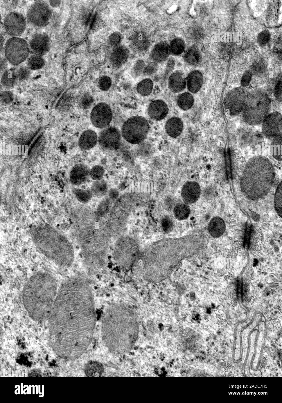 Transmission electron micrograph (TEM) showing the cytoplasm of ...