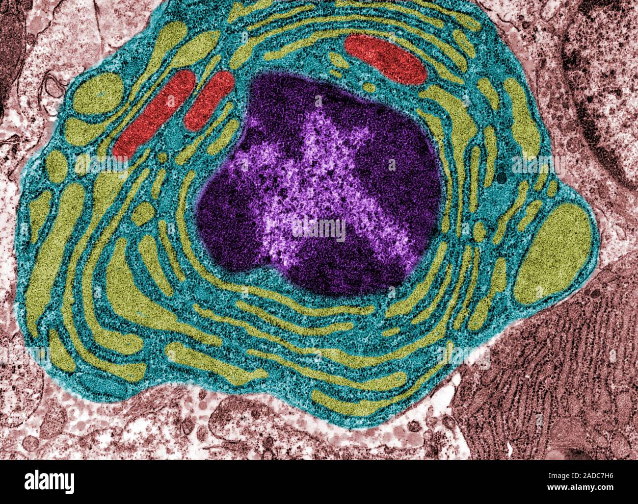 False colour transmission electron micrograph (TEM) showing a plasma ...